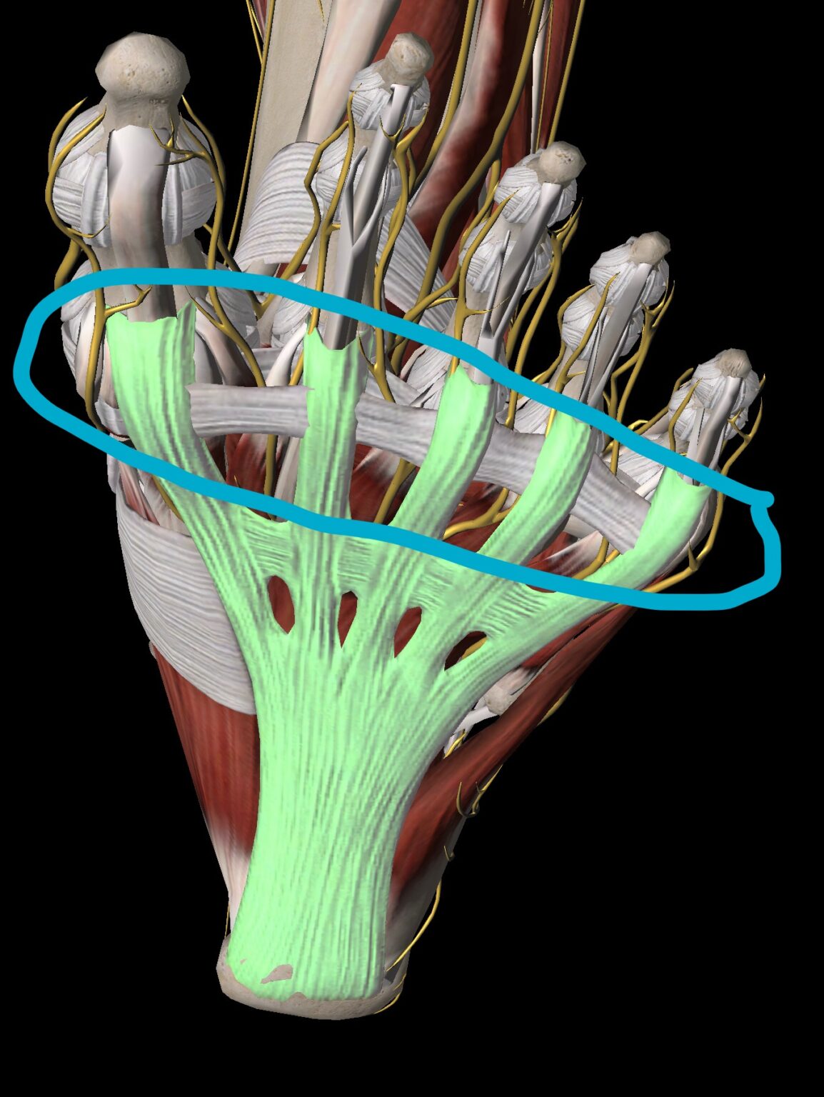 Plantar Plate Injuries - Waikato Podiatry