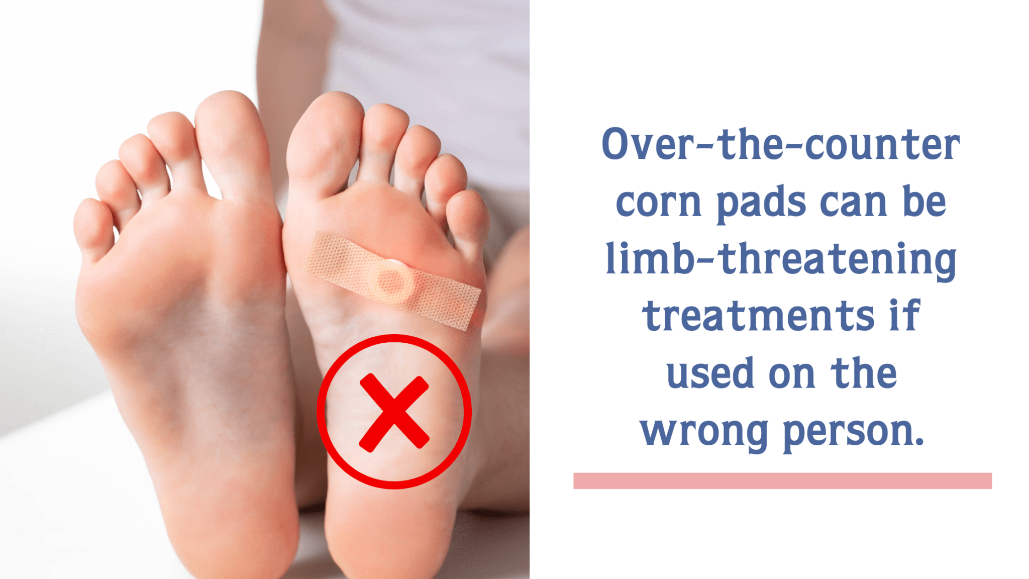 Understanding Corns and Calluses: Why DIY Treatments Might be Risky ... Understanding Corns and Calluses: Why DIY Treatments Might be Risky ...