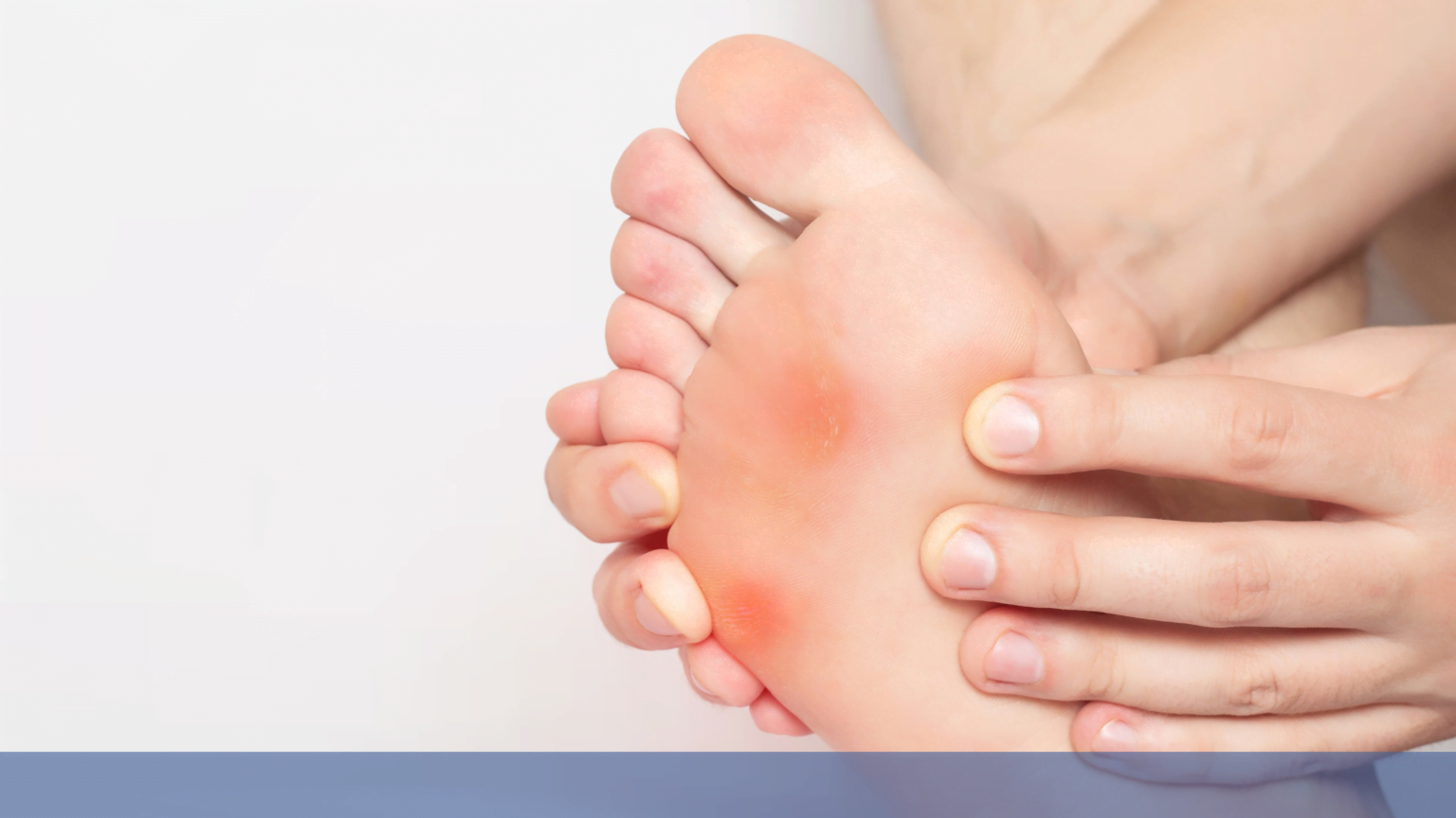 Understanding Corns and Calluses: Why DIY Treatments Might be Risky ...