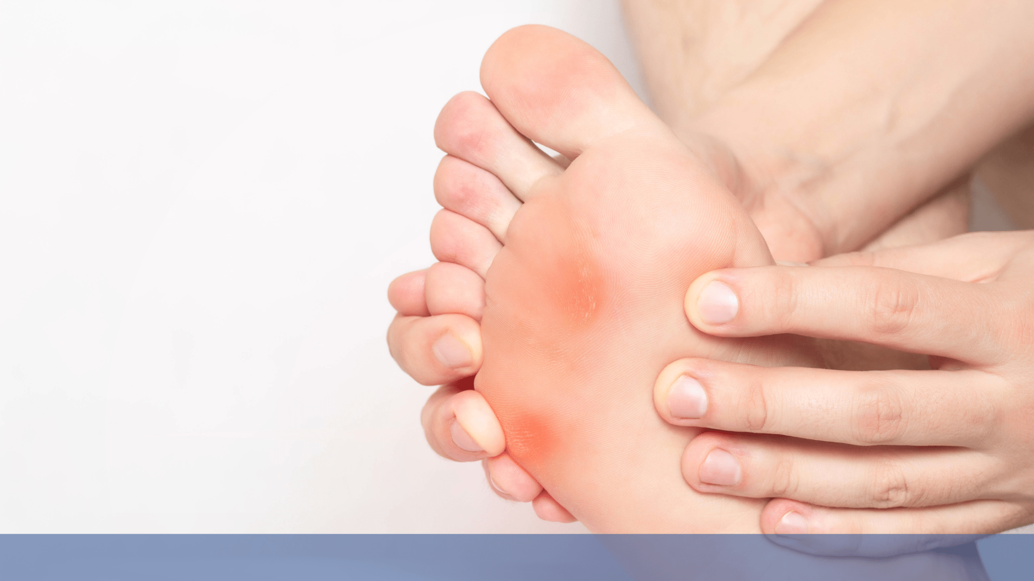 Understanding Corns and Calluses: Why DIY Treatments Might be Risky ...